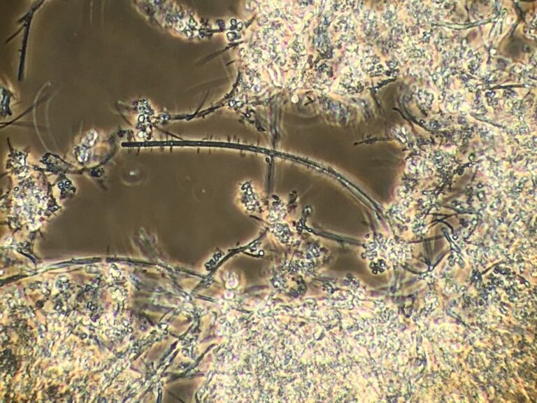 Exploring Syntrophic Bacterial Relationships in Wastewater Treatment ...